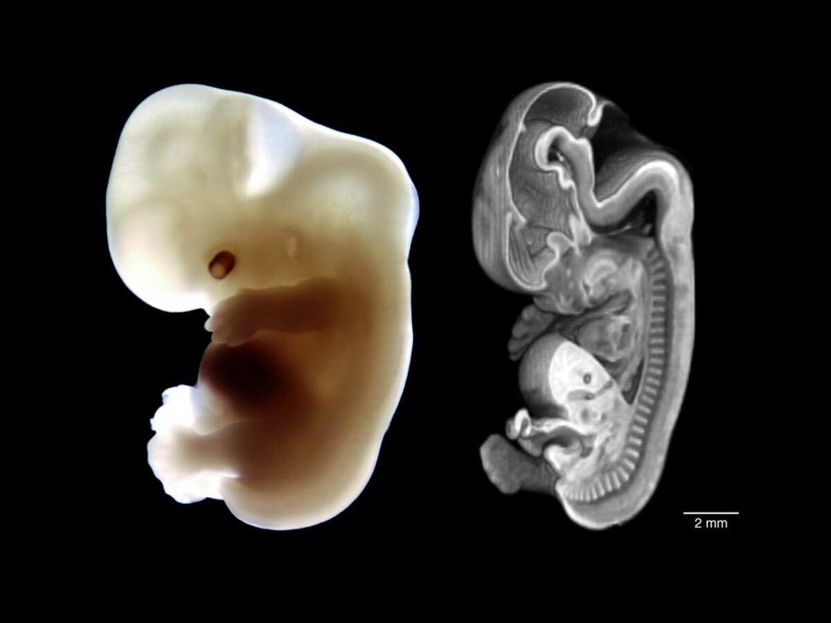 Brad Smith: Optical and MRI Embryo | U-M Stamps
